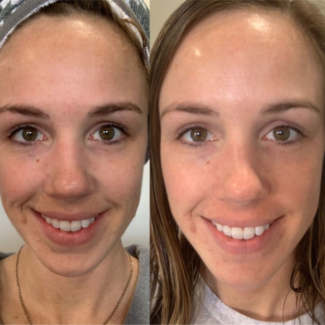 Hanacure® | High-Performance Skincare