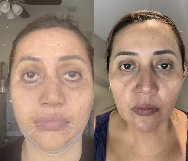 Hanacure® | High-Performance Skincare