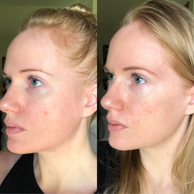 Hanacure® | High-Performance Skincare